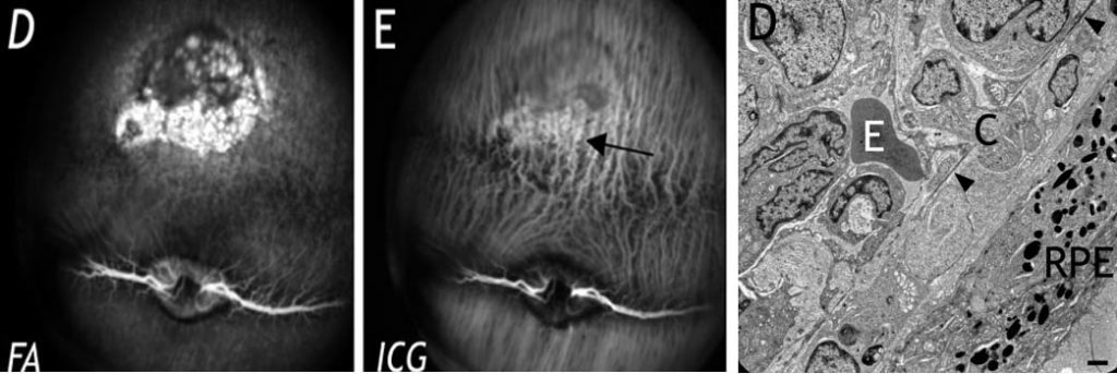 Ocular angiogenesis - ocutox
