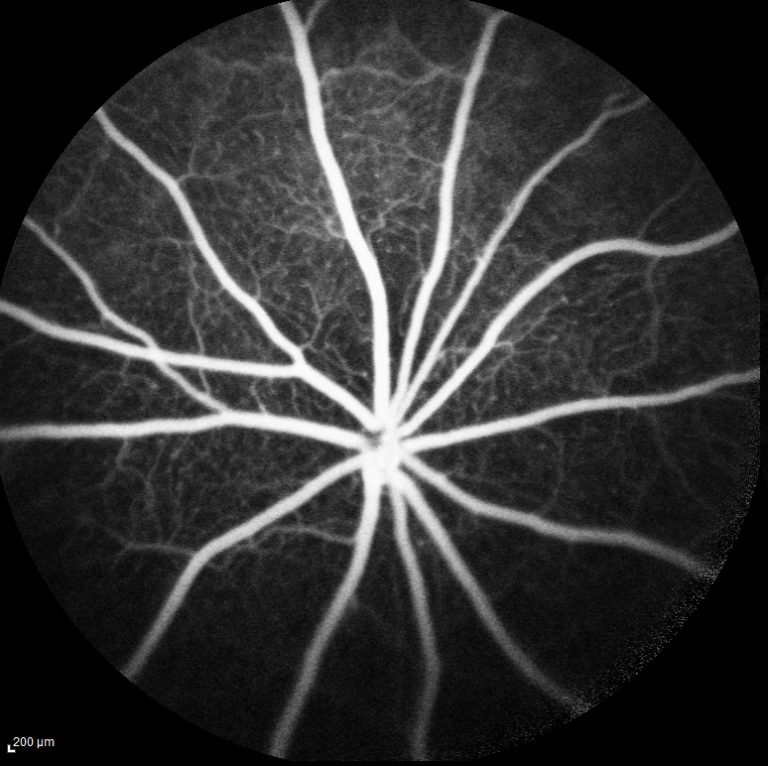Scanning Laser Ophthalmoscopy (SLO) - ocutox
